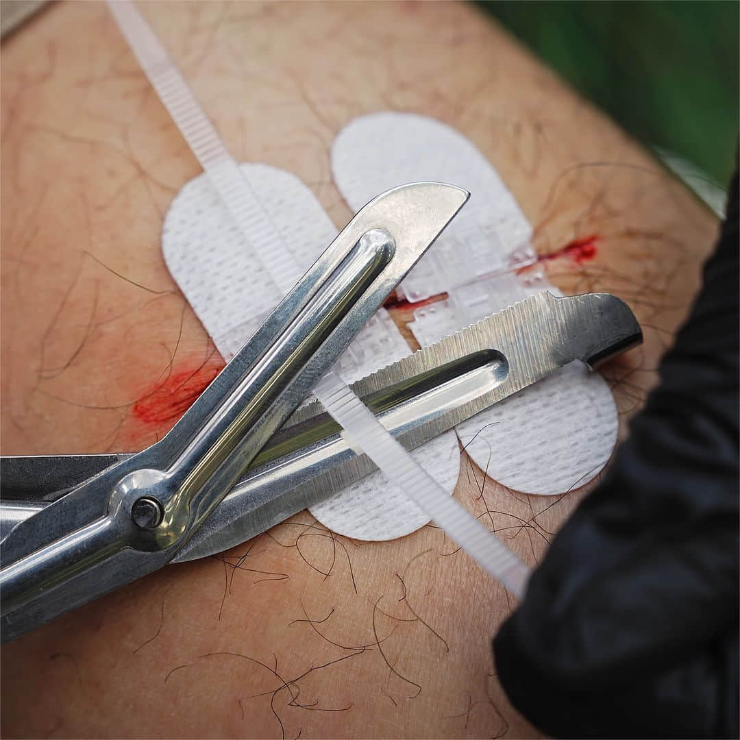 Premium Zip Stitch Suture-Free Wound Closure Kit | HSA/FSA Eligible ...